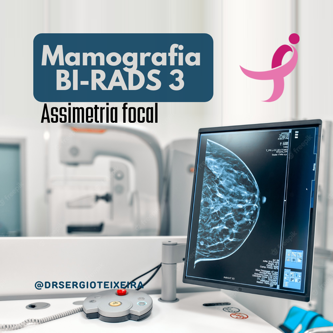 Mamografia BI-RADS 3, e agora ? – Sérgio Teixeira