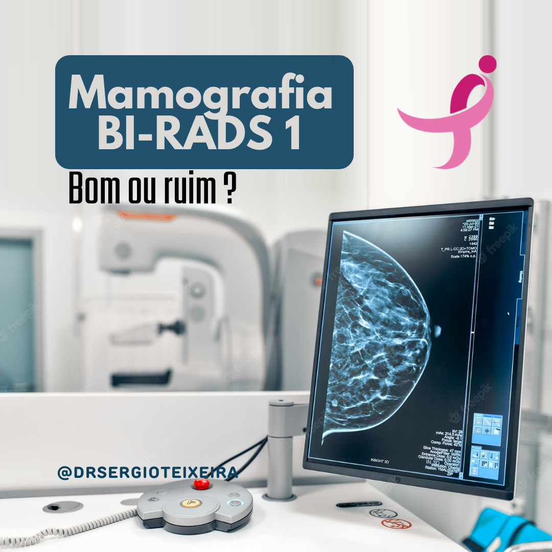 BI-RADS 1 é melhor que BI-RADS 0 ? – Sérgio Teixeira